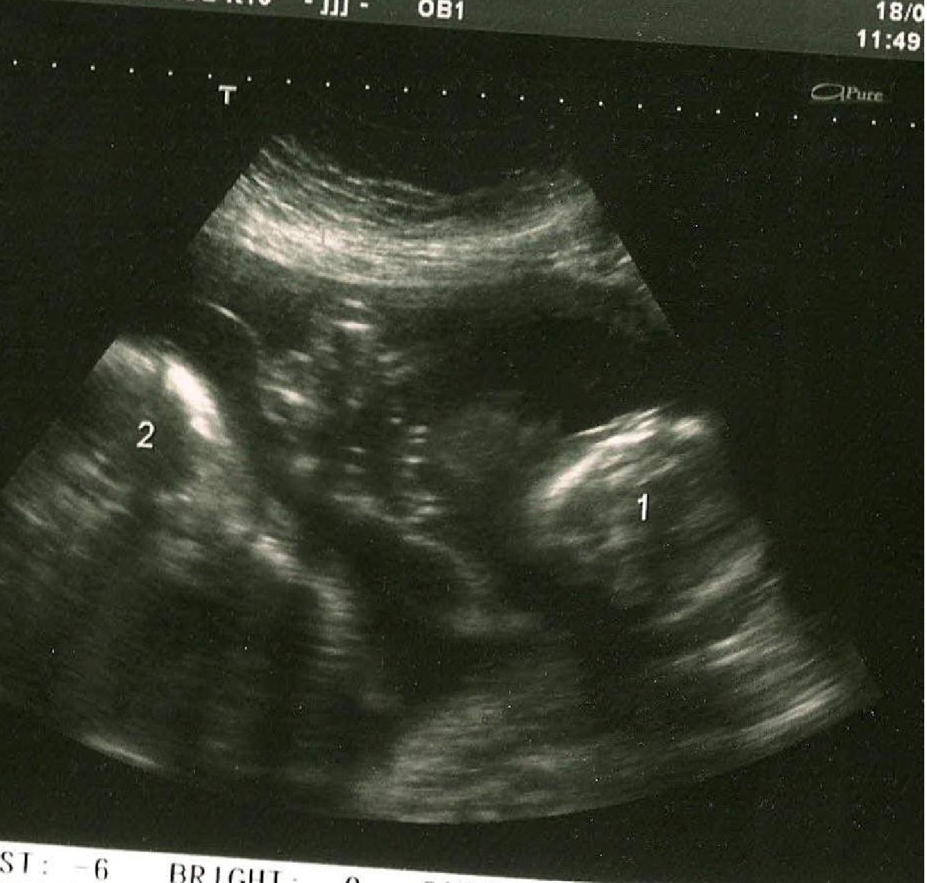 55555555 | Simplement 2